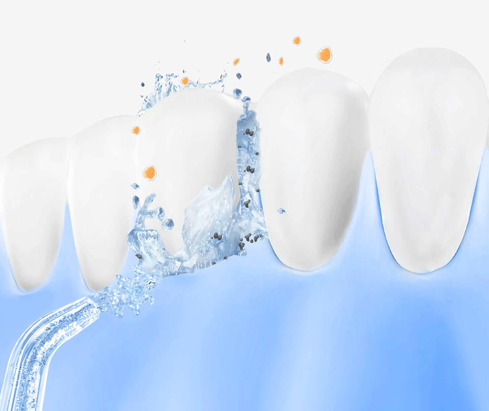 MiOT Crowdfunding Launches the DOCO LAB Mini Water Flosser | MIOT ...